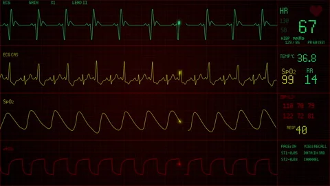Patient monitor displays vital signs ECG... | Stock Video | Pond5