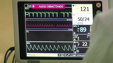 Patient Monitor at Emergency Room in Hos... | Stock Video | Pond5