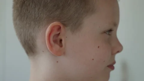 Peeling and desquamation of skin on chil... | Stock Video | Pond5