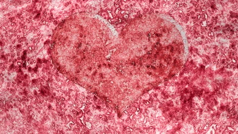 pen and ink - Heart attack animation | Stock Video | Pond5