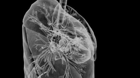 Pericardium Stock Video Footage | Royalty Free Pericardium Videos | Pond5