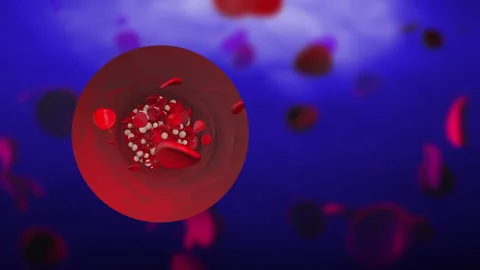 peripheral feet with blood clot animatio... | Stock Video | Pond5