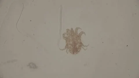 Pest Bug Under Microscope 4K Super Magni... | Stock Video | Pond5