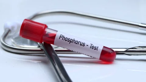 Phosphorus test to look for abnormalitie... | Stock Video | Pond5