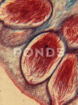 Photograph: Photo under microscope of fungi growth on the plant cells ...