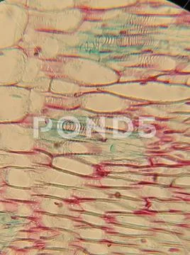 Photo under microscope of fungi growth on the plant cells Stock Photo ...