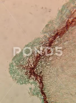 Photo under microscope of fungi growth on the plant cells ~ Premium ...