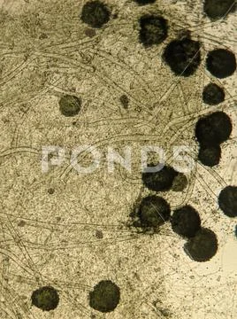 Photograph: Photo under microscope of fungi growth on the plant cells ...