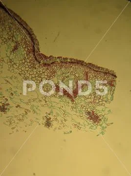 Photograph: Photo under microscope of fungi growth on the plant cells ...