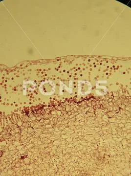 Photo under microscope of fungi growth on the plant cells ~ Premium ...