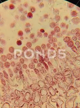 Photo under microscope of fungi growth on the plant cells ~ Hi Res ...