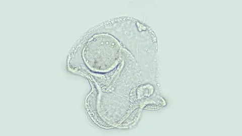 Pilidium larva of worm Heteronemertea un... | Stock Video | Pond5