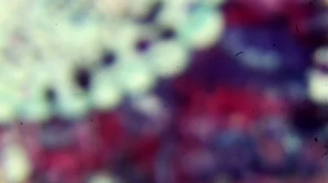 Pine needle cross-section under the micr... | Stock Video | Pond5