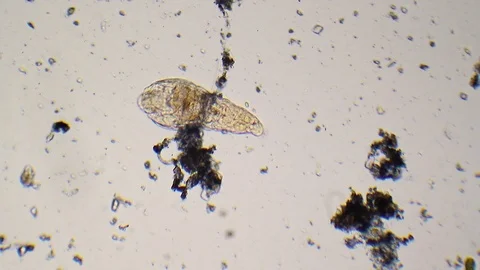 Rotifer Stock Video Footage | Royalty Free Rotifer Videos | Pond5