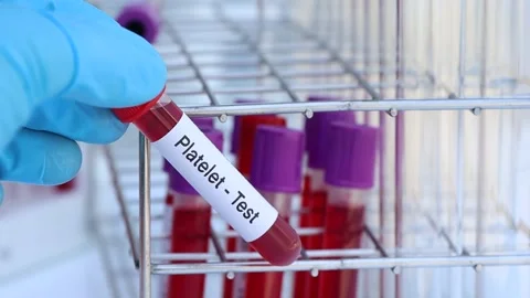 platelet test to look for abnormalities ... | Stock Video | Pond5