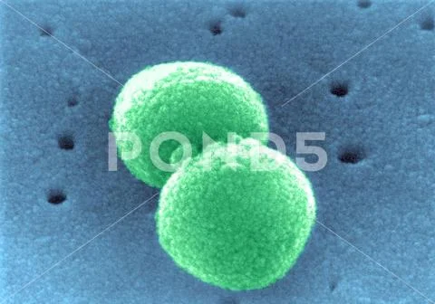 Pneumococcus Scanning Electron Micrograph of Streptococcus pneumoniae ...