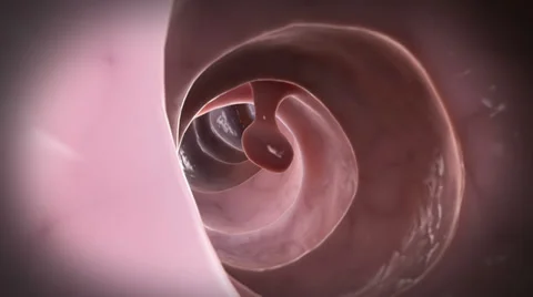 Inside Colon Stock Video Footage | Royalty Free Inside Colon Videos | Pond5