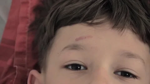 Portrait of a sad boy with a scratch and... | Stock Video | Pond5