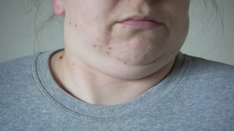 Portrait of sagging fat hanging skin, wr... | Stock Video | Pond5