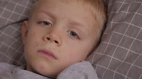 Portrait of a small sick boy in bed, wit... | Stock Video | Pond5