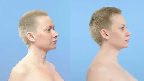 portrait of a woman . comparison before ... | Stock Video | Pond5