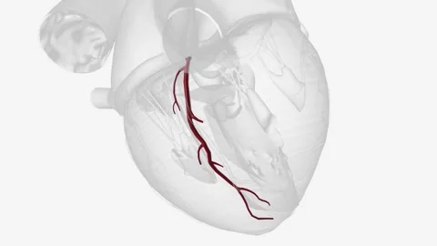 Posterior interventricular branch of rig... | Stock Video | Pond5