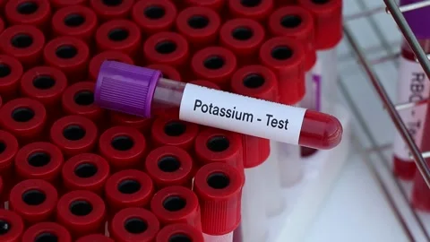 Potassium test to look for abnormalities... | Stock Video | Pond5