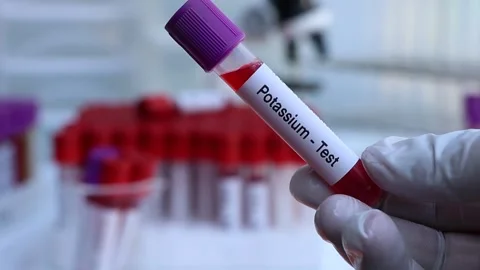 Potassium test to look for abnormalities... | Stock Video | Pond5
