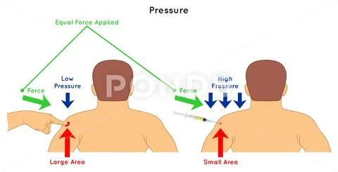Pressure Infographic Diagram example touching shoulder by finger and ...