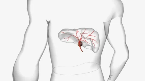 Primary Biliary Cholangitis Cirrhosis 3d... | Stock Video | Pond5