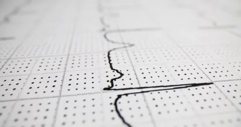 Printout of an ECG or EKG graph showing ... | Stock Video | Pond5