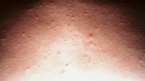 Zit Stock Videos – Royalty-Free HD & 4K Videos