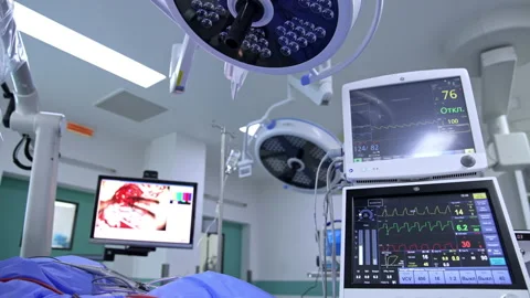Process of surgical operation displayed ... | Stock Video | Pond5