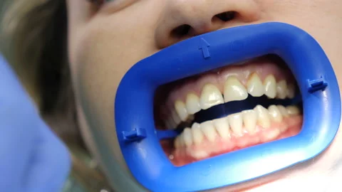 Female Cosmetic Dentist Stock Videos – Royalty-Free HD & 4K Videos