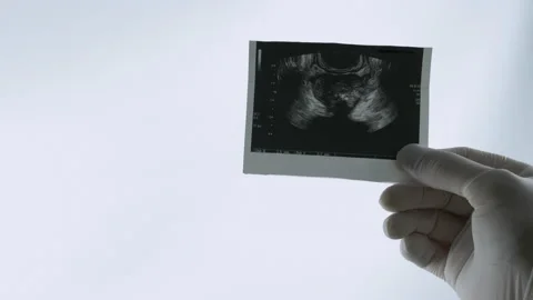 Male Prostate Stock Footage ~ Royalty Free Stock Videos | Pond5