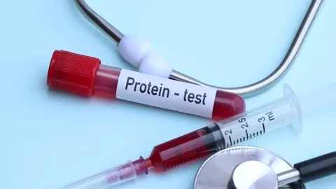 protein test to look for abnormalities f... | Stock Video | Pond5