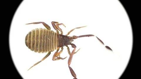 Psocoptera Stock Video Footage | Royalty Free Psocoptera Videos | Pond5