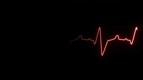Pulse animation. Heartbeat. Cardiogram o... | Stock Video | Pond5