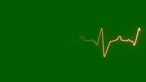 Pulse animation. Heartbeat. Cardiogram o... | Stock Video | Pond5