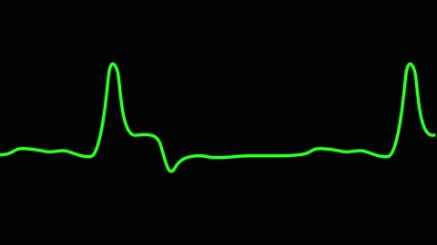 Pulse of the heartbeat green color. EKG ... | Stock Video | Pond5