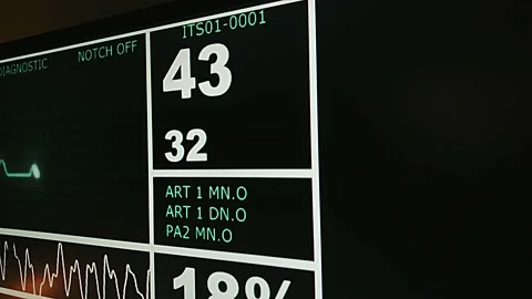 Hospital Monitor Stop Patients Stock Video Footage | Royalty Free ...