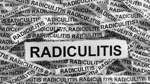 Radiculitis Stock Footage ~ Royalty Free Stock Videos | Pond5