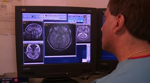 Radiologist reading MRI Brain scan | Stock Video | Pond5