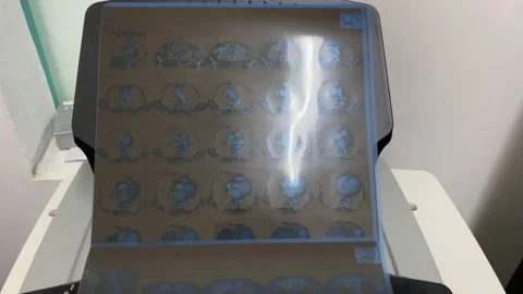 radiology film printing process | Stock Video | Pond5