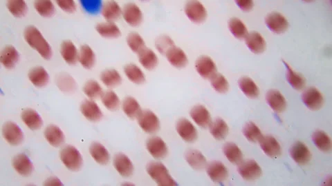 RBC and WBC under microscope. HQ video. ... | Stock Video | Pond5