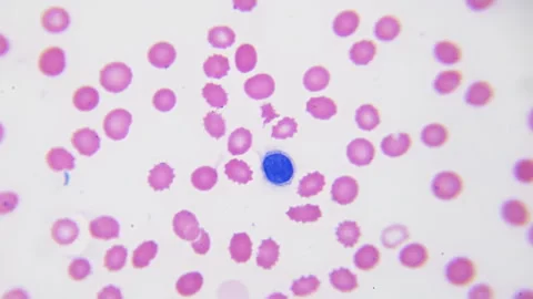 RBC and WBC under microscope. HQ video. ... | Stock Video | Pond5