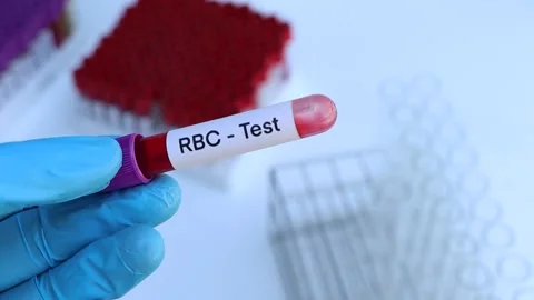 RBC test to look for abnormalities from ... | Stock Video | Pond5