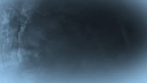 The reaction of black ink in water | Stock Video | Pond5