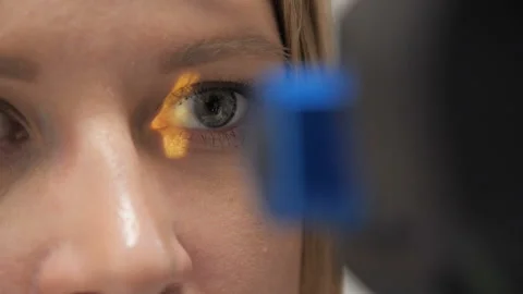 The reaction of the pupil of the human e... | Stock Video | Pond5