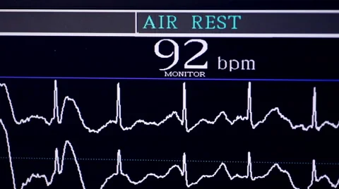 Real Cardiogram. Working cardiograph in ... | Stock Video | Pond5